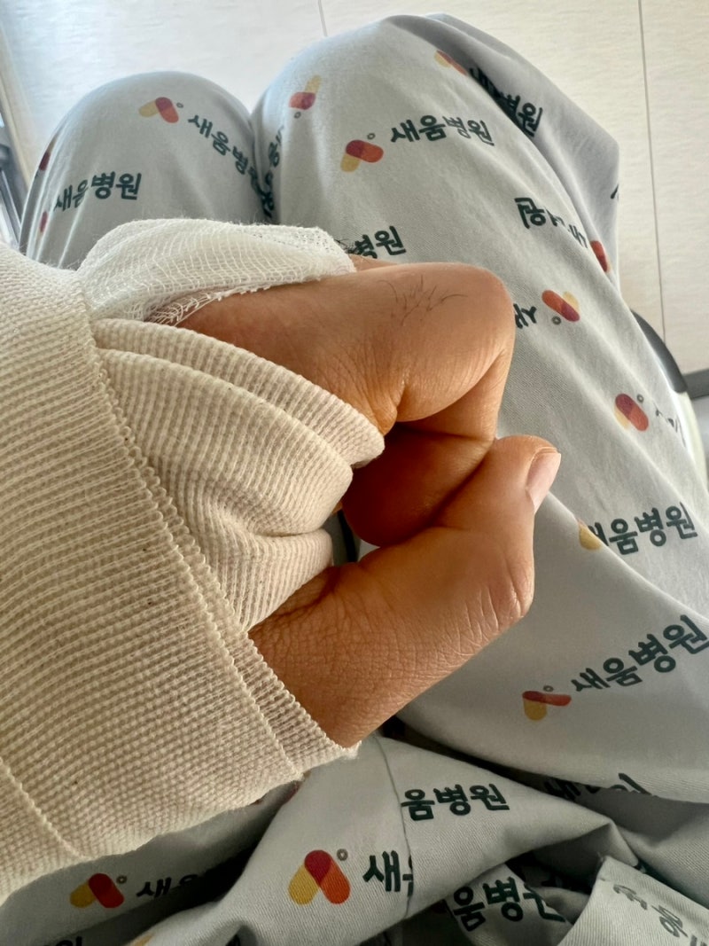 척골충돌증후군 Tfcc인대 손상 수술 후기2 독산동 새움병원 정우성원장님 수술 네이버 블로그