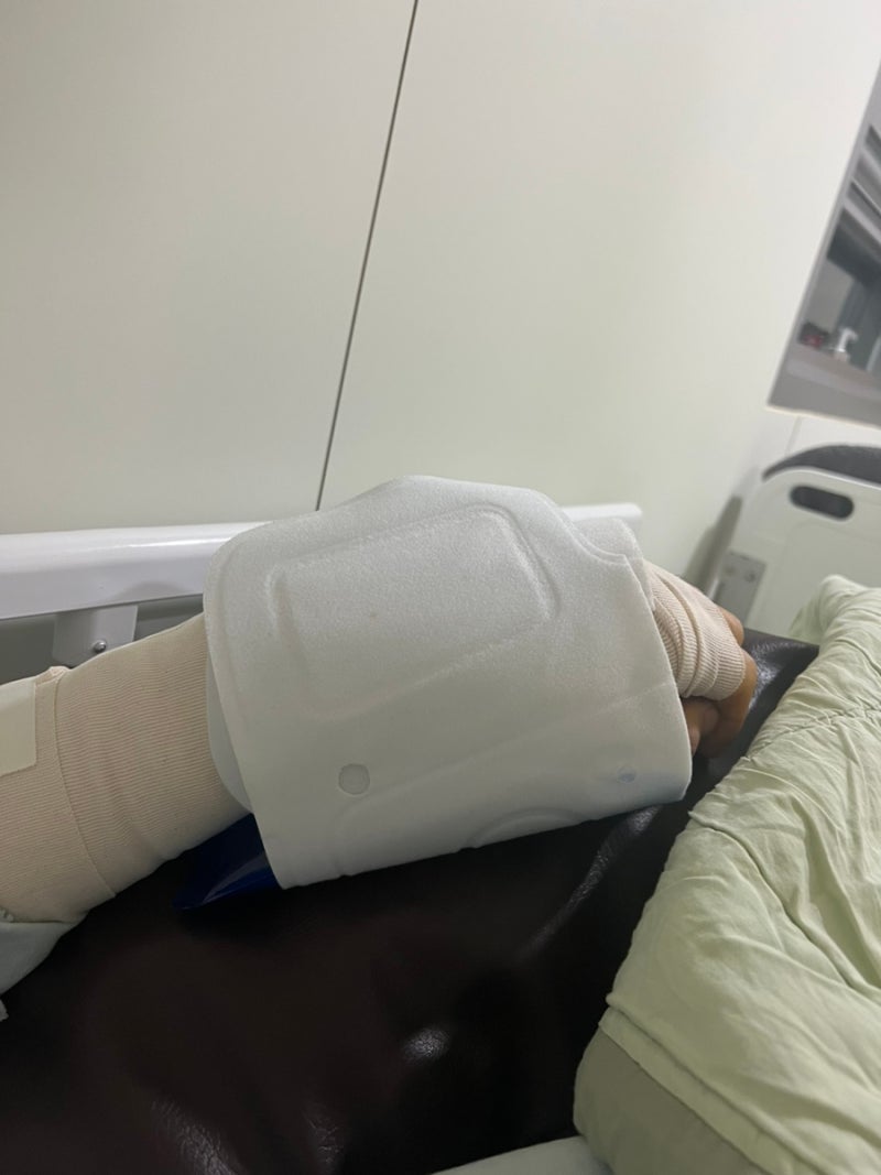 척골충돌증후군 Tfcc인대 손상 수술 후기2 독산동 새움병원 정우성원장님 수술 네이버 블로그
