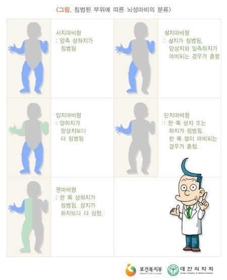 뇌성마비cerebral Palsy원인 및 증상 And 재활치료 네이버 블로그