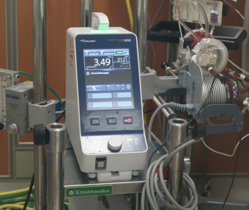 ECMO 간호 3 :: Ecmo 종류, Weaning, CRRT, setting, 모니터링, 알람 : 네이버 블로그