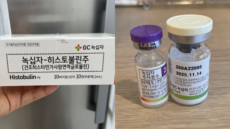 알레르기 원인과 히스토불린 주사 치료 후기 네이버 블로그
