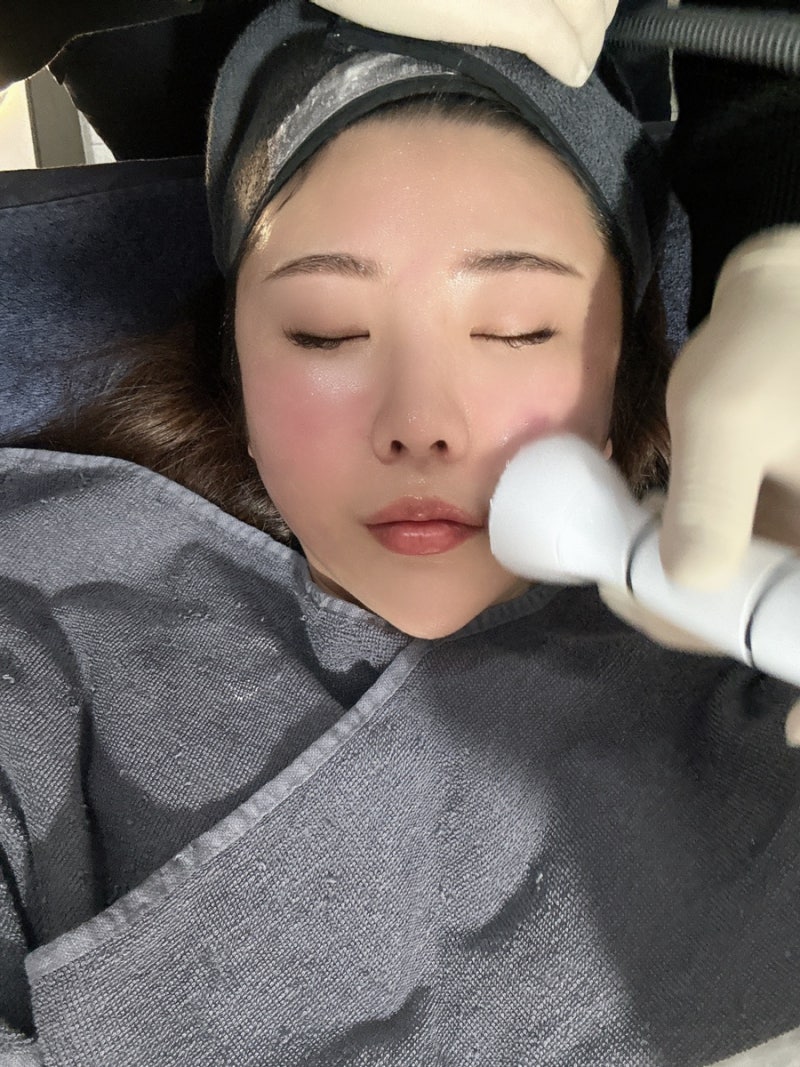 명동 피부과 여드름흉터 시크릿레이저 내돈내산 후기 네이버 블로그