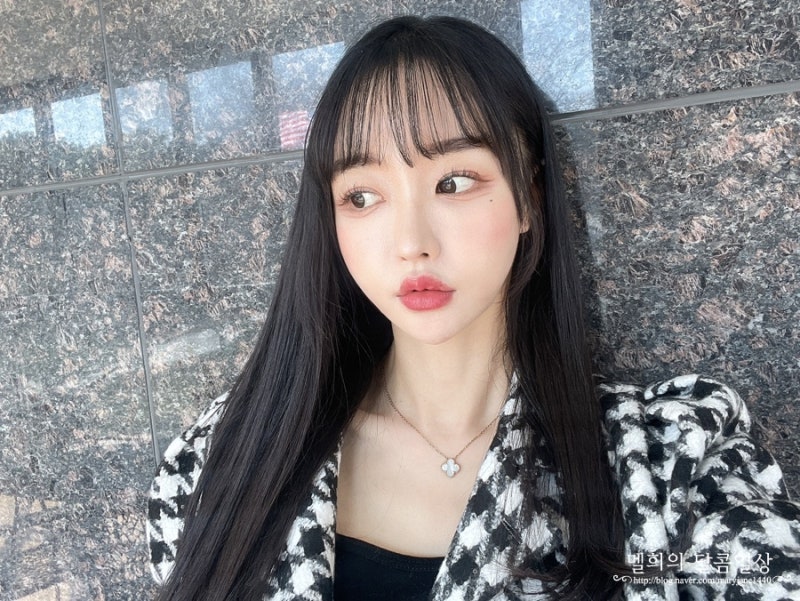 리볼라인 입술필러 전후 솔직 후기 입꼬리 보톡스 네이버 블로그