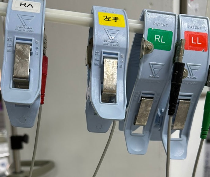 EKG 모니터로 알 수 있는 것 : EKG 부착 작동방법 : 네이버 블로그