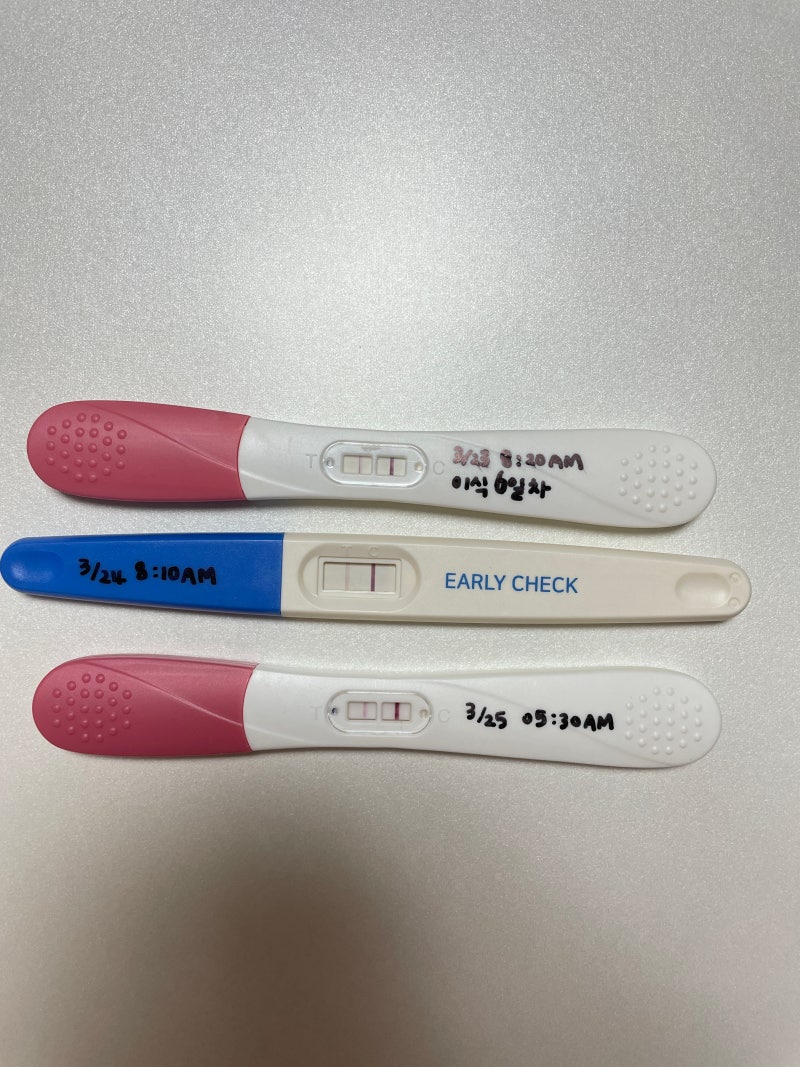 난임일기20 동결 5일배양 감자배아 이식 후 증상 임테기 두줄 그리고 화학적 유산 네이버 블로그