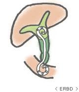 ENBD, ERBD, PTCD, EST, EPBD, ERCP의 검사 차이와 개요 : 네이버 블로그