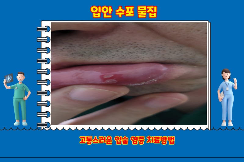 입안 생기는 증상 하얀거 물집 염증 수포 피멍울 원인과 해결 방법 네이버 블로그