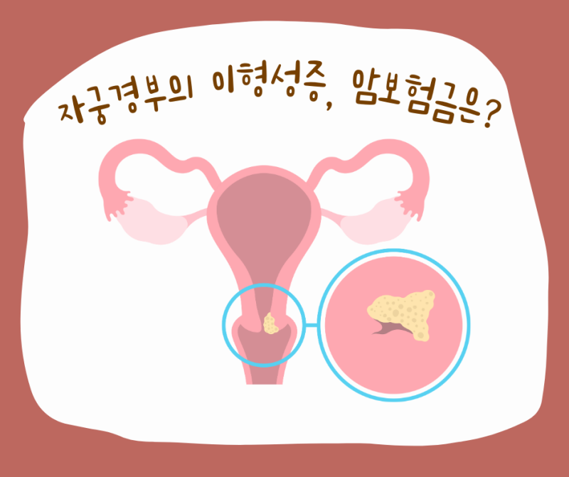 자궁경부 이형성증n87제자리암 소액암보험금은 D06 네이버 블로그