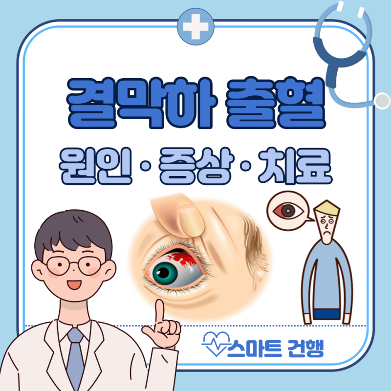 결막하출혈 원인 및 증상과 치료 눈 실핏줄 터짐 눈 핏줄혈관 터졌을때 네이버 블로그