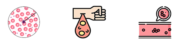 PB Smear 말초 혈액 도말 Blood Cell Morphology 혈구 형태 검사 알아보기 : 네이버 블로그