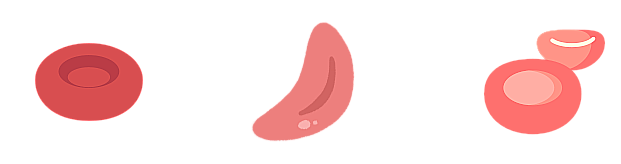 PB Smear 말초 혈액 도말 Blood Cell Morphology 혈구 형태 검사 알아보기 : 네이버 블로그