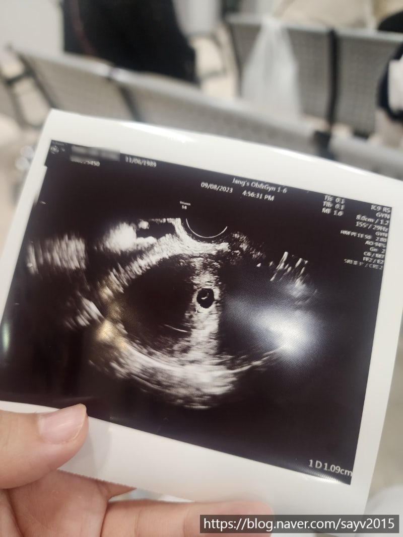 아기심장소리 시기 검사 방법 아기 적정 심장 박동 수 알아보기 네이버 블로그