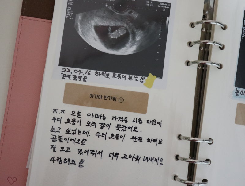 아기집 보이는 시기 난황 태아 심장소리 시기 임신5주차 증상 네이버 블로그