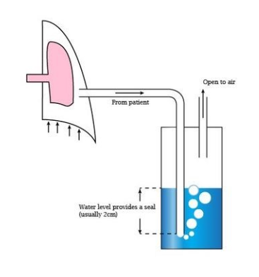 CTD bottle 간호 및 주의사항 : 네이버 블로그