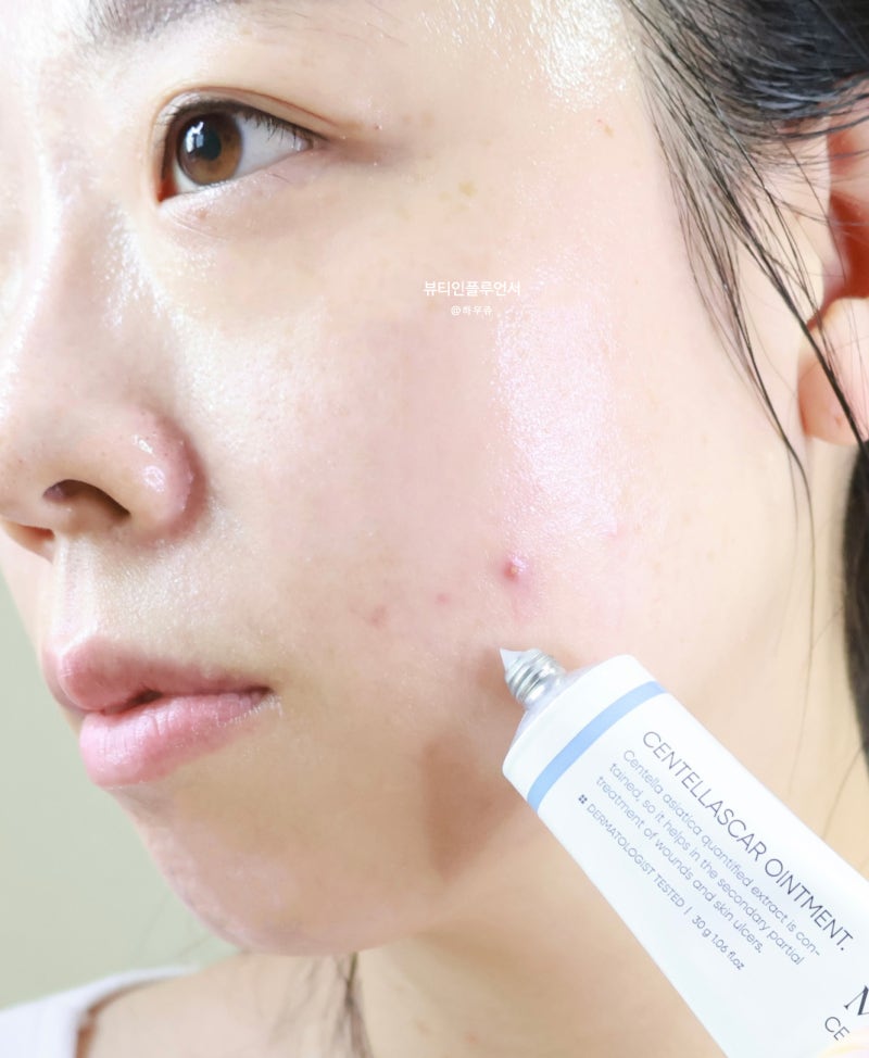 마일드랩 센텔라스카 연고 내돈내산 일주일 찐후기 올리브영 추천템 네이버 블로그