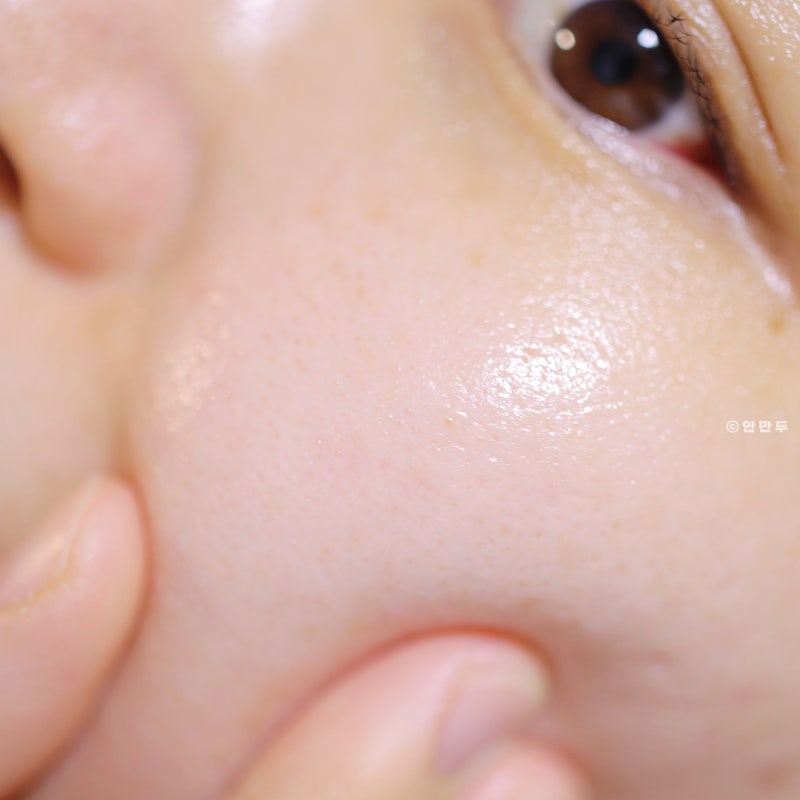 주름개선 화장품 리소엔 사과 엑소좀 크림 후기 네이버 블로그