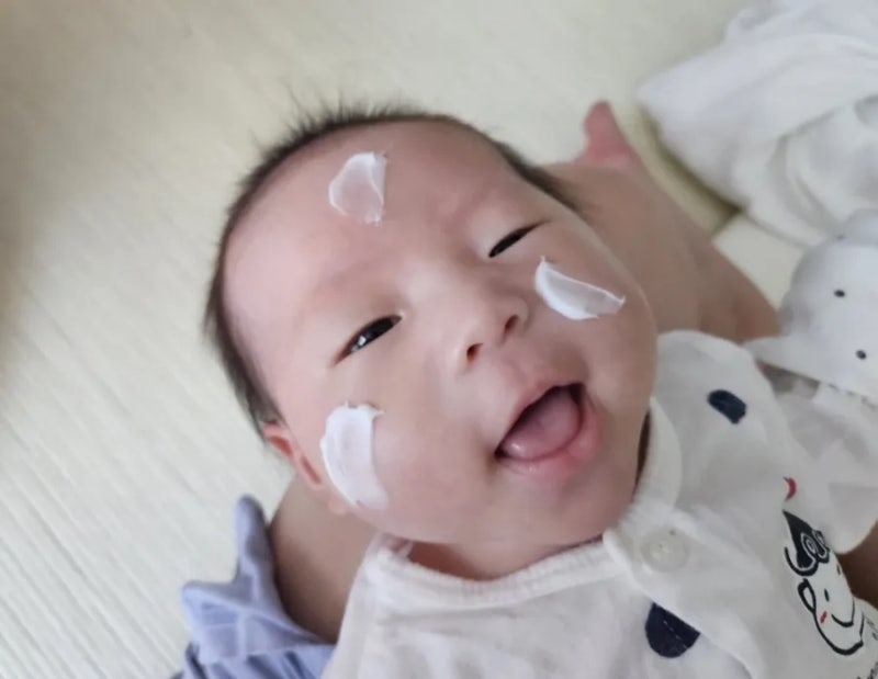 신생아 태열 뜻 원인 증상 관리 해결방법 아기 접촉성 피부염 네이버 블로그