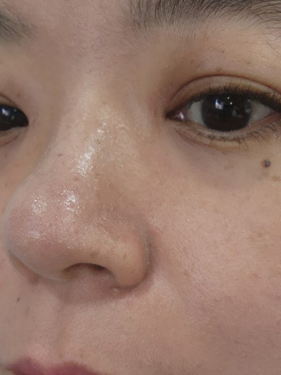 임산부 피부관리 잘하는 남양주 다산 에스테틱 피부관리샵 오늘의뷰티 네이버 블로그