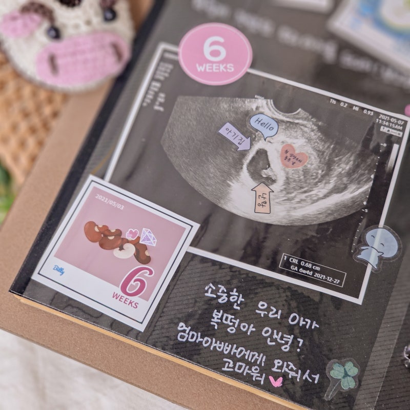 얼리 임신테스트기 사용시기 다이소 임테기 사용법 정확도 희미한 두줄 위치 가격 네이버 블로그