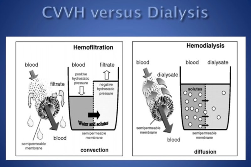 CRRT mode 모드 공부하기 SCUF, CVVH, CVVHD, CVVHDF : 네이버 블로그