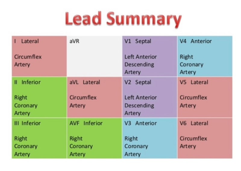 CAG 의학용어 LAD, LCX, RCA 확인하는 법 : 네이버 블로그