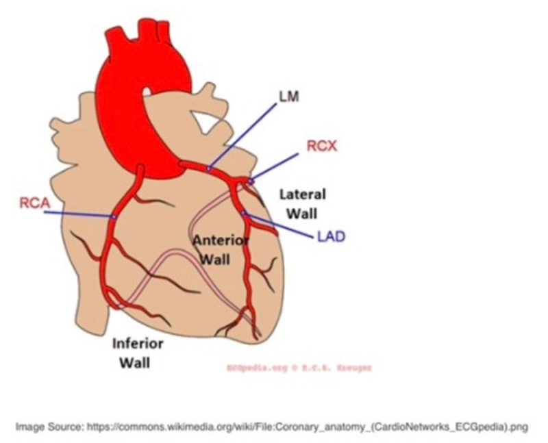 CAG 의학용어 LAD, LCX, RCA 확인하는 법 : 네이버 블로그