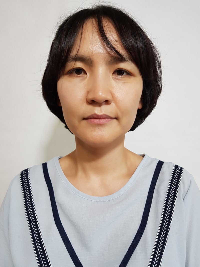 상안검수술후기 비용 회복기간 느낀점 : 네이버 블로그