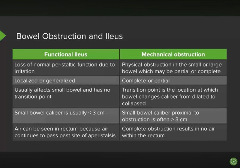 Ileus 장폐색 증상, 진단, 치료, 입원, 음식 공부하기 : 네이버 블로그