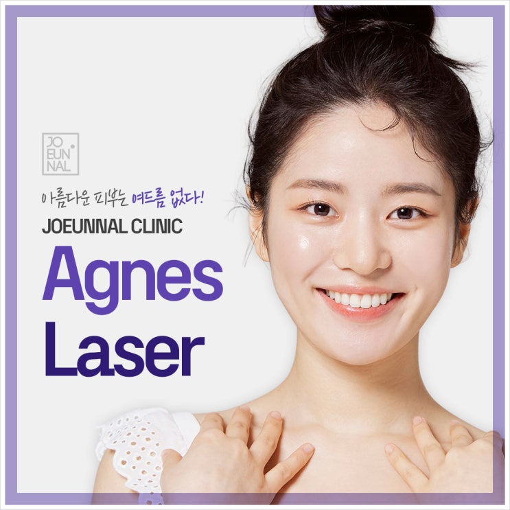 아그네스 레이저로 여드름 피부 개선할 수 있을까 대치동 피부과