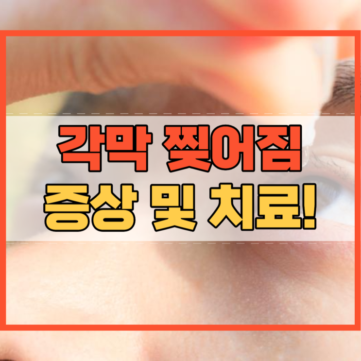 각막 찢어짐 원인 및 증상 예방까지 알아봐요