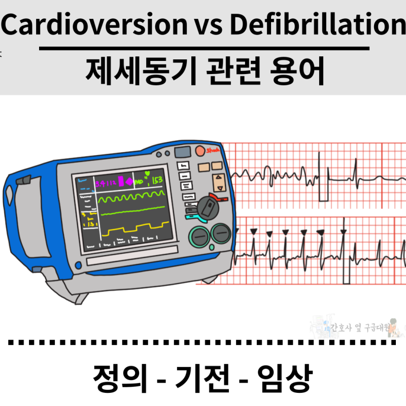 제세동 관련 용어 정의 : Cardioversion vs Defibrillation : 네이버 블로그