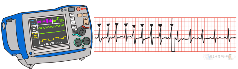 제세동기 사용법 : 임상에서의 Cardioversion vs Defibrillation : 네이버 블로그