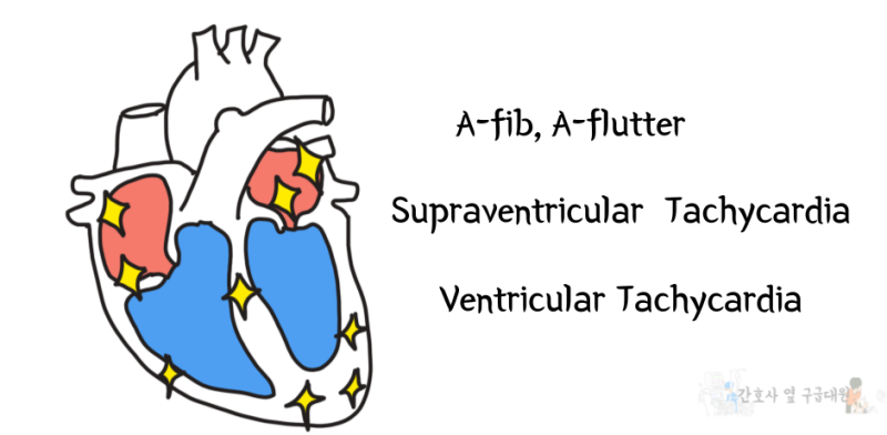 제세동기 사용법 : 임상에서의 Cardioversion vs Defibrillation : 네이버 블로그