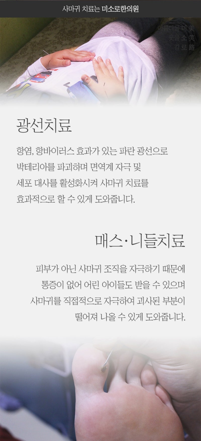 수원사마귀치료 조직을 밀어내게 만드는 한방 방식으로 : 네이버 블로그