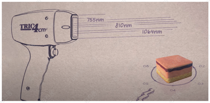 티타늄 리프팅 잘 받으려면.. STACK모드? SHR모드? 리프팅 제대로 받기 : 네이버 블로그