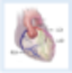 RWMA = regional wall motion abnormality (심장의 국소 벽 이상증) 간단 공부 : 네이버 블로그