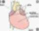 RWMA = regional wall motion abnormality (심장의 국소 벽 이상증) 간단 공부 : 네이버 블로그