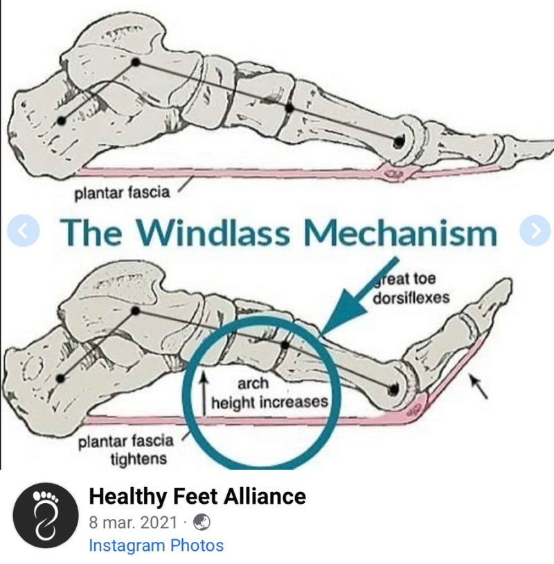 윈드라스메커니즘 windlass mechanism : 네이버 블로그