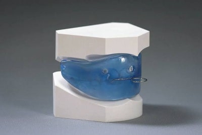 근기능장치 적응증, 치료효과 정리: 프리올쏘 (Preortho), EF line : 네이버 블로그