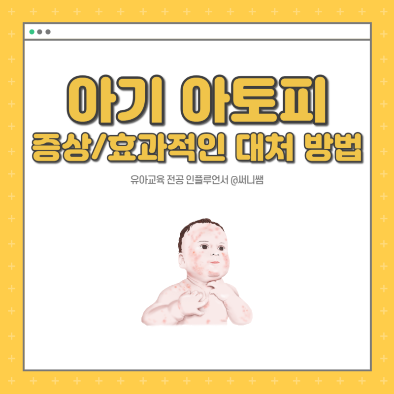 아기 아토피 초기 증상 원인 연고 로션 크림 치료방법 네이버 블로그