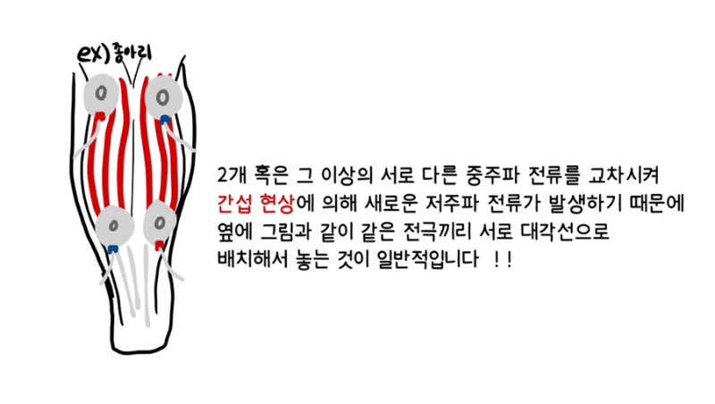 물리치료 전기치료간섭파ict에 대해 알아보기 네이버 블로그