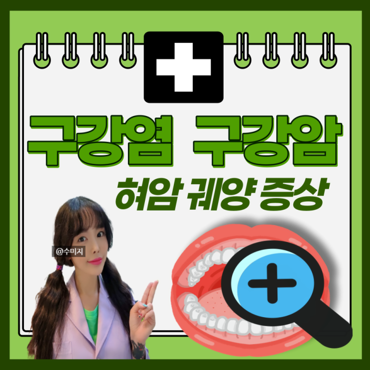 구강암 구강염 혀암 설암 증상 초기증상 구강궤양 입속 궤양