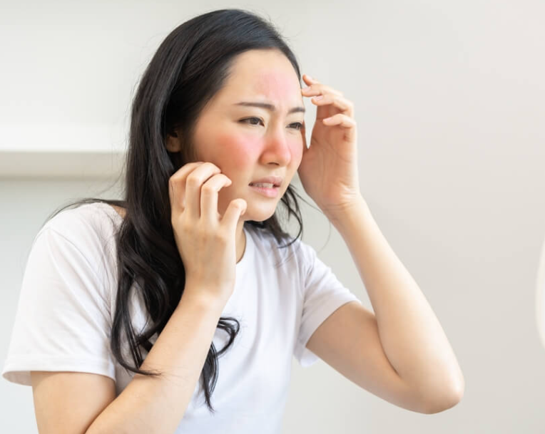아나필락시스 쇼크 진단 증상 및 원인 응급처치 치료 방법 총정리 네이버 블로그