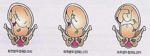 태위 태세 태향 엄청 쉽게 이해하기! : 네이버 블로그