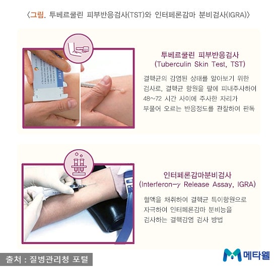 잠복결핵 양성 진단으로 치료 꼭 해야할까 잠복결핵 치료기간 치료 약 검사 증상 예방 네이버 블로그