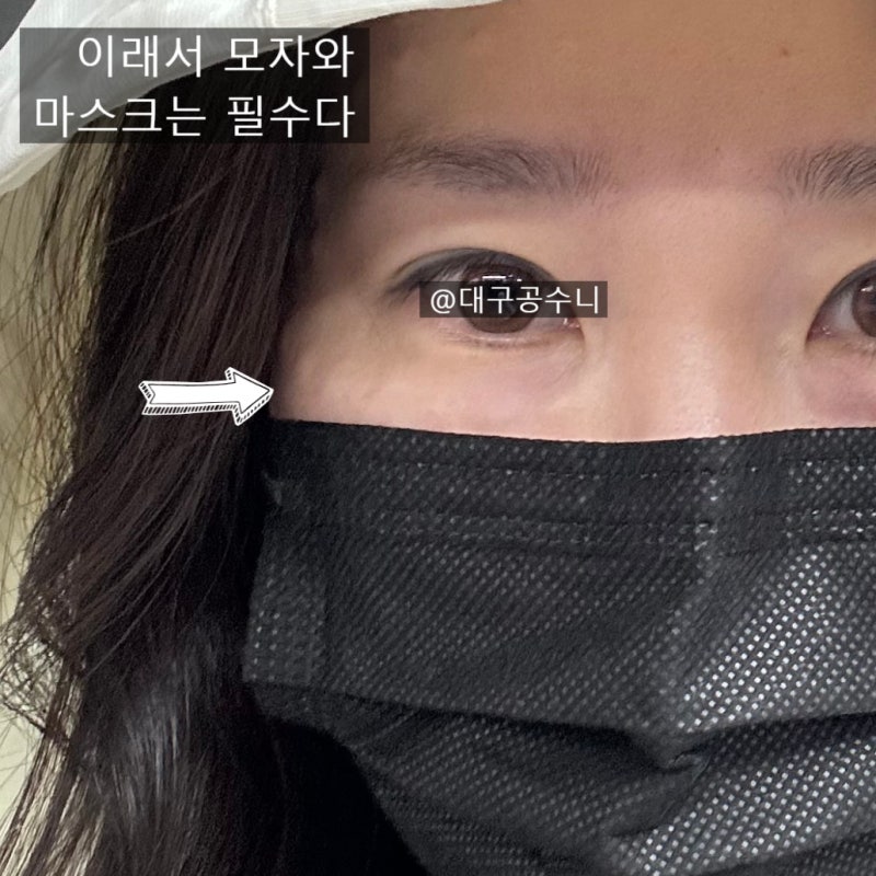 연어주사 리쥬란힐러hb플러스 3cc 가격 부작용 효과 시기 멍 통증 엠보 후기 네이버 블로그