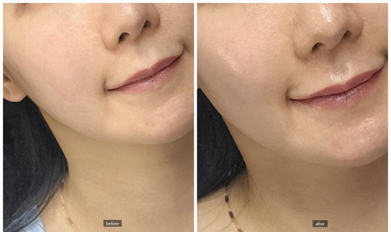 안티에이징 앰플 가성비 좋은 대용량 바로 이 제품 블리블리 바쿠치올 슈퍼 바이옴 리프팅 앰플 네이버 블로그