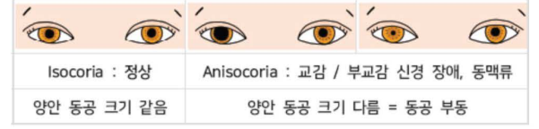 3. 임상간호사 기초편 - GCS / Motor grade / pupil 사정 : 네이버 블로그