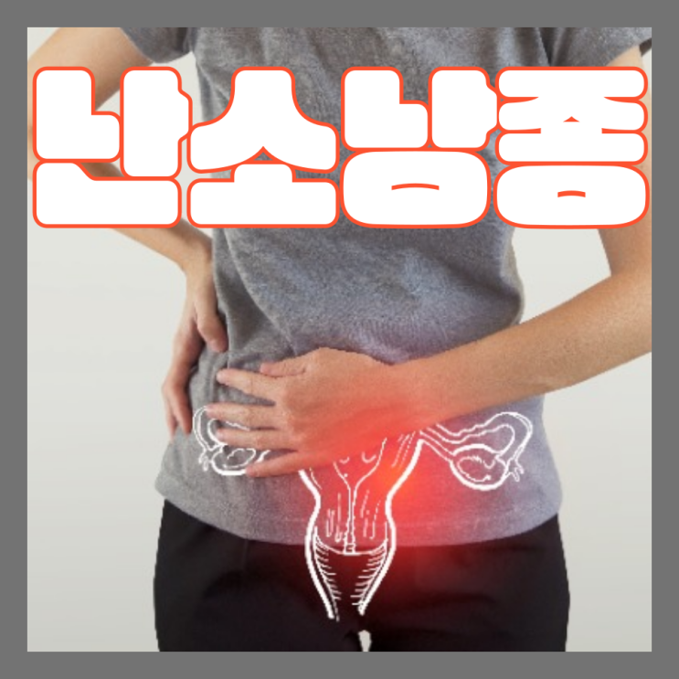 난소낭종 파열과 증상 및 난소낭종 수술난소암증상 검사