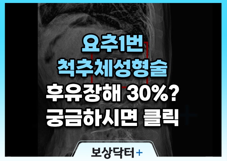 요추1번골절 척추체 성형술 후유 장해 지급률 30 3000만 원 보상 사례 네이버 블로그